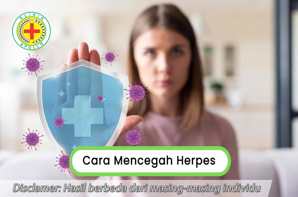 Mengenal 7 Cara yang Efektif untuk Mencegah Herpes | Klinik Apollo Jakarta