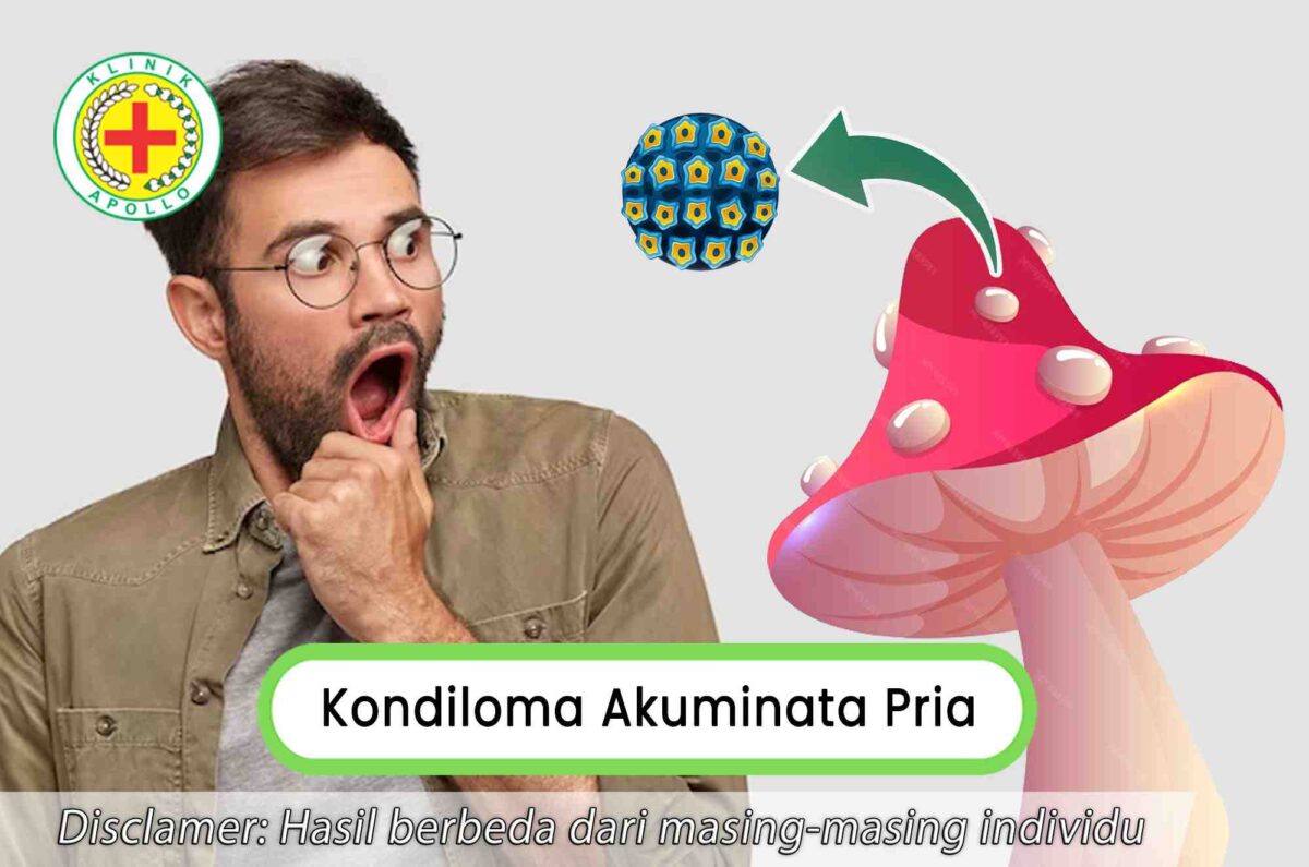 Mengetahui Lebih Lanjut tentang Kondiloma Akuminata Pria | Klinik ...