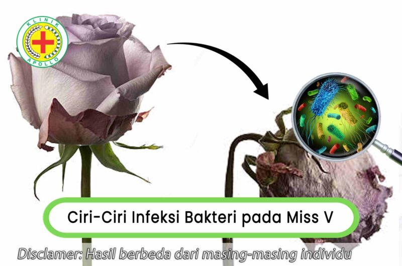 Waspada! Ini Dia 7 Tanda atau Ciri-Ciri Infeksi Bakteri pada Miss V ...