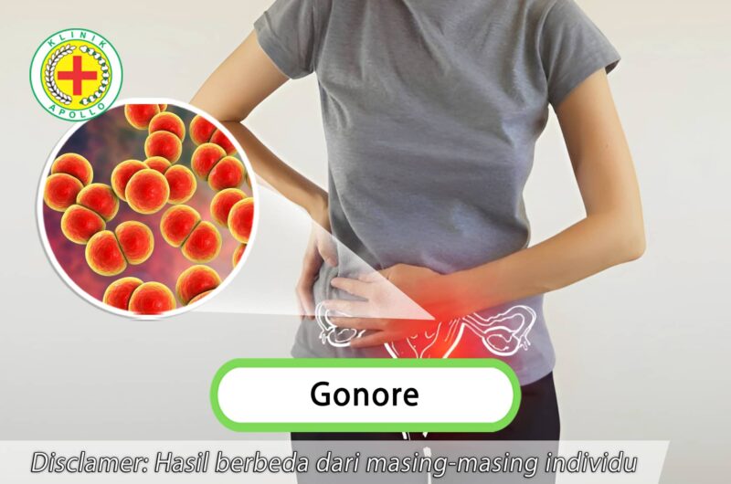 9 Ciri-Ciri Orang Terinfeksi Gonore, Berikut Cara Mengobatinya | Klinik ...