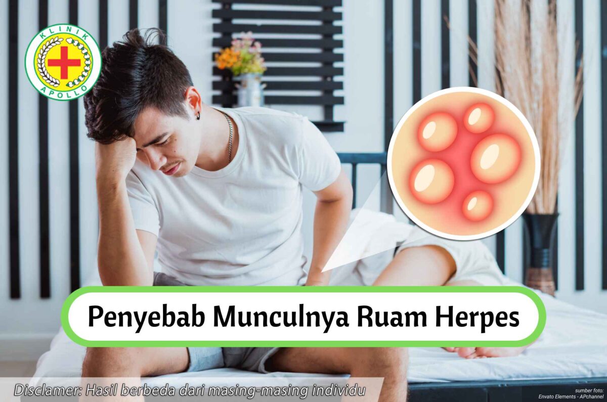 5 Penyebab Munculnya Ruam Herpes, Intip Cara Mengobatinya | Klinik Apollo Jakarta