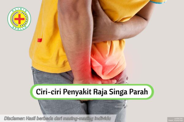 7 Ciri-ciri Penyakit Raja Singa Parah Berikut Pengobatannya | Klinik ...
